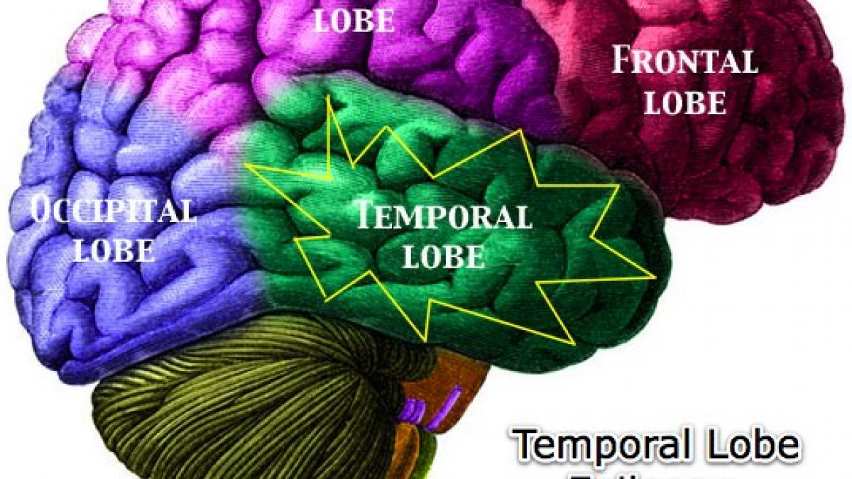 What Is Temporal Lobe Epilepsy